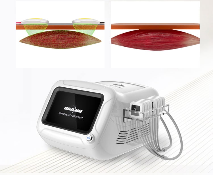 RF Non-invasive Fat Reduction & Body Contouring Equipment - OSANO