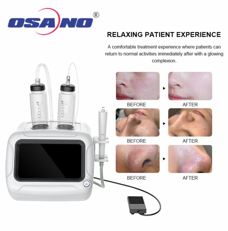 Best Pimple Face Cleaning Machine - Osano